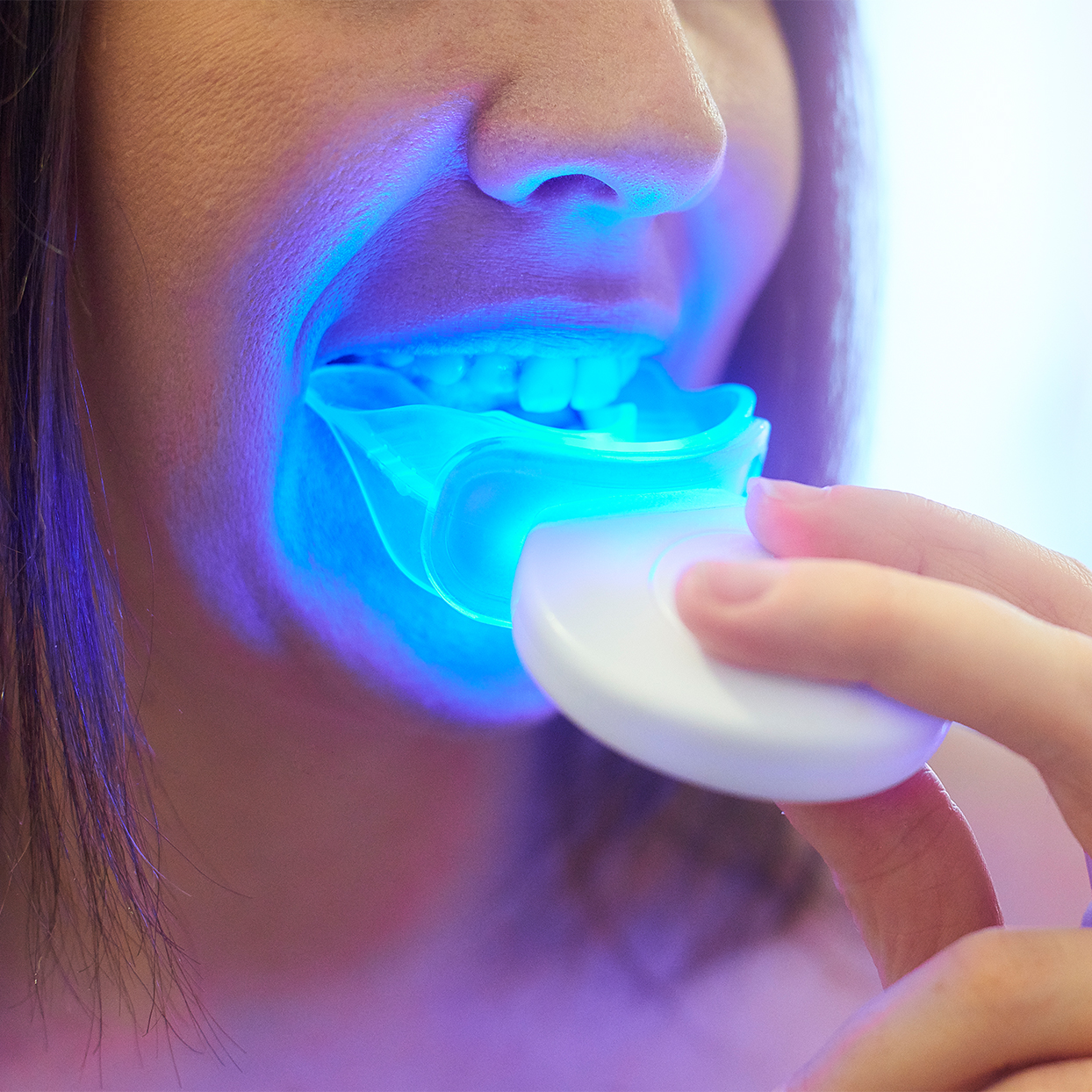 Everything You Need to Know About Teeth Whitening
