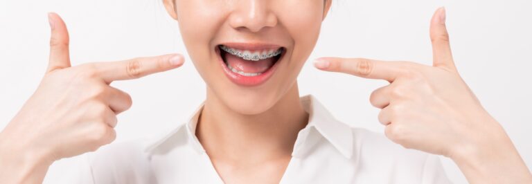 How to Fix Buck Teeth | WeSmile Dental