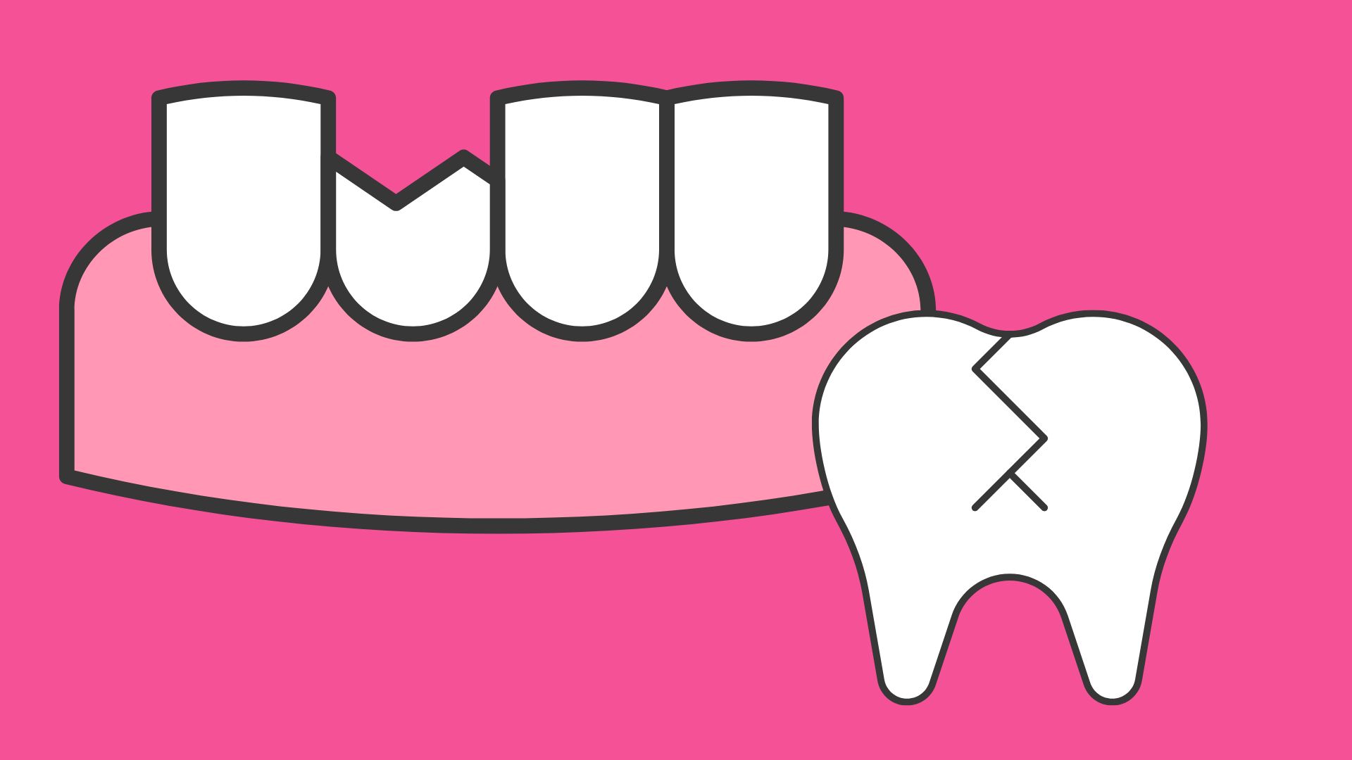 A Step by Step Guide to Fixing Your Chipped Tooth