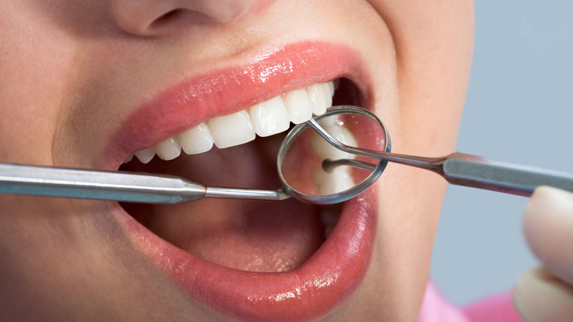 A Step by Step Guide to Fixing Your Chipped Tooth