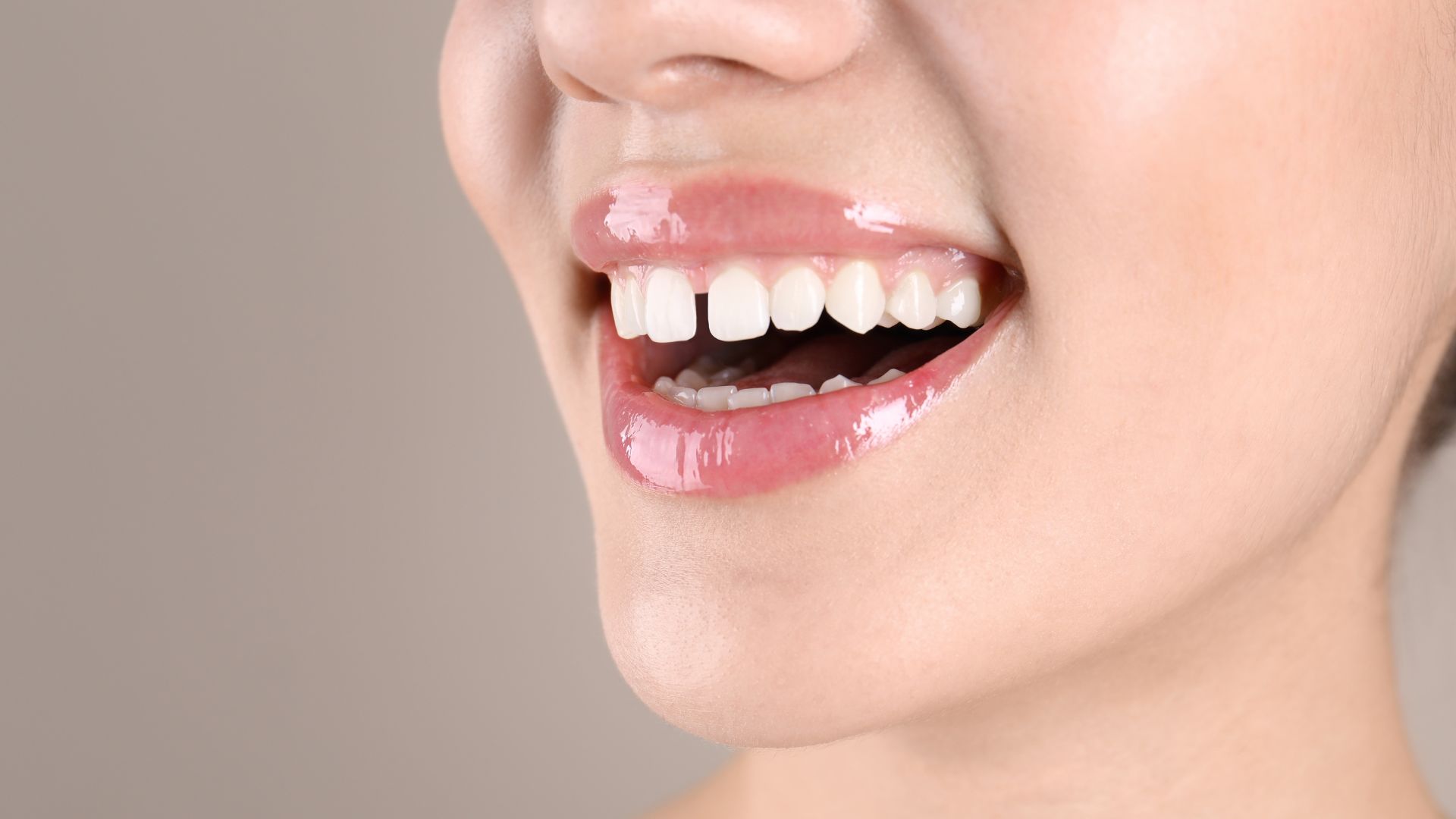 Teeth gaps: A complete guide - WeSmile Dental