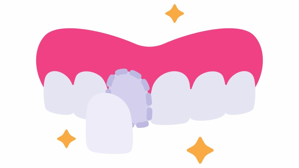 Teeth gaps: A complete guide - WeSmile Dental