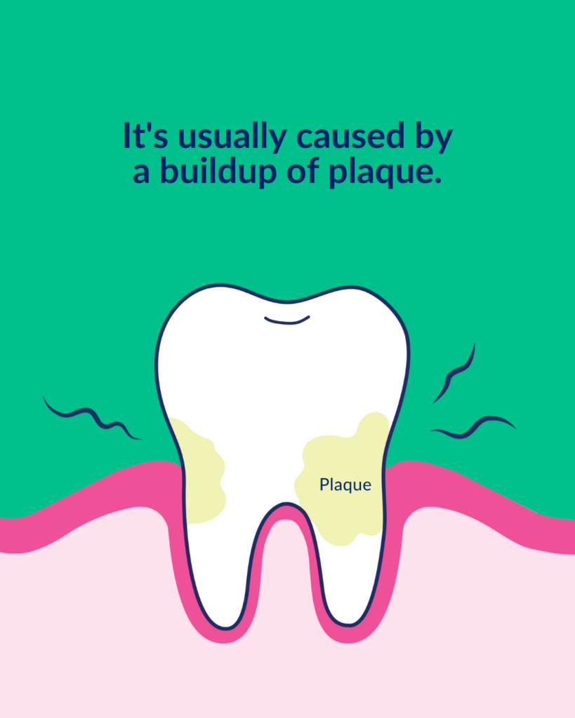 What is periodontitis & how to treat it? | WeSmile Dental