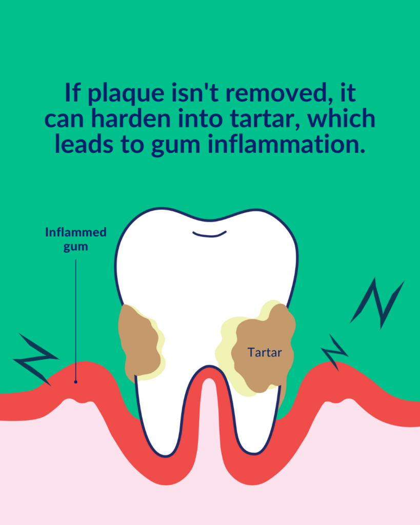 What is periodontitis & how to treat it? | WeSmile Dental