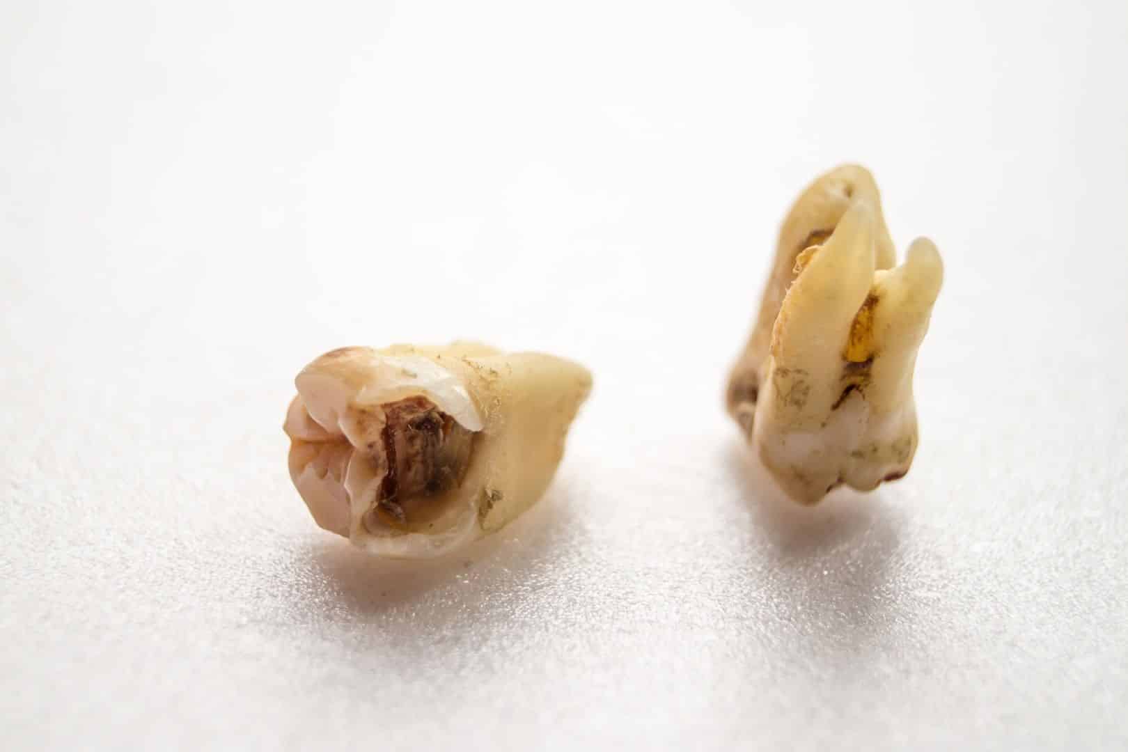 Dental Appointments For The Elderly | WeSmile Dental Care