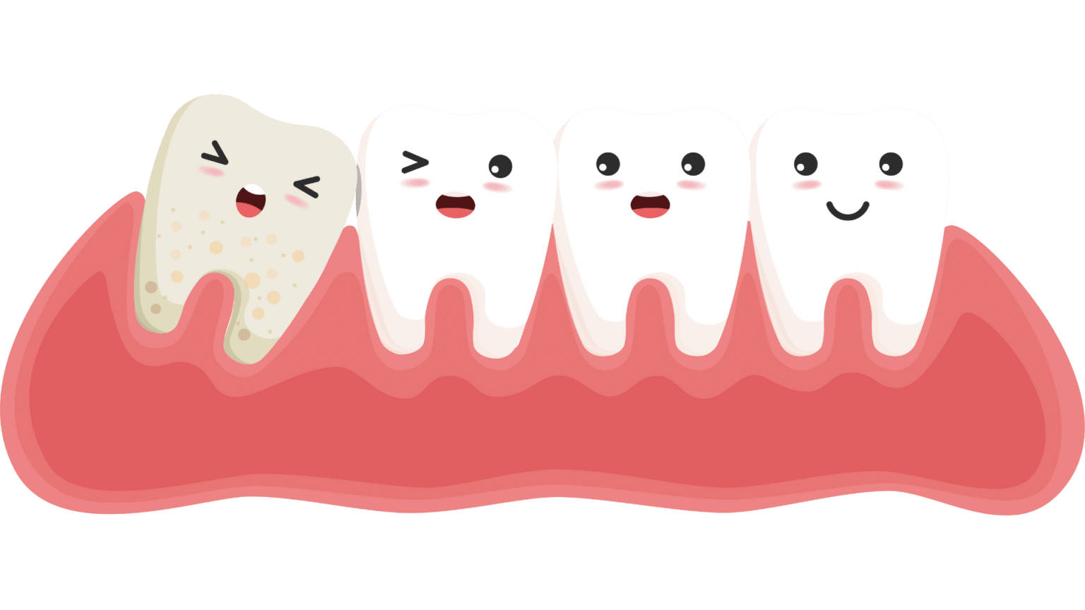 Impacted tooth: Do I need extraction? | WeSmile Dental Care