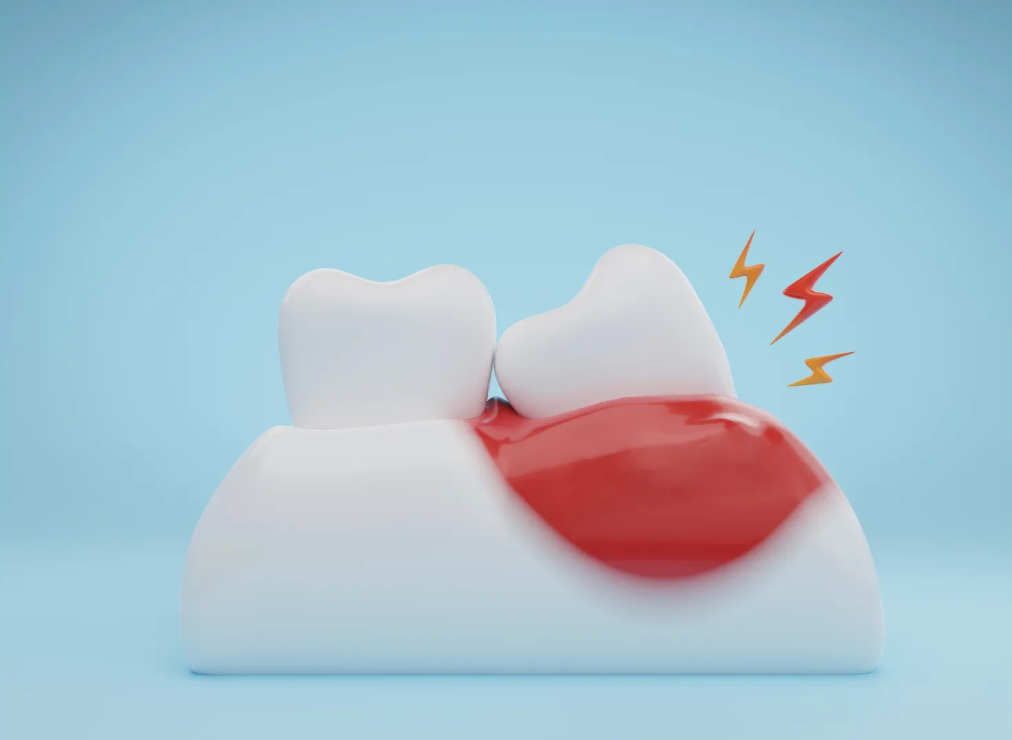 Wisdom Tooth Pain: What You Need to Know and How to Find Relief