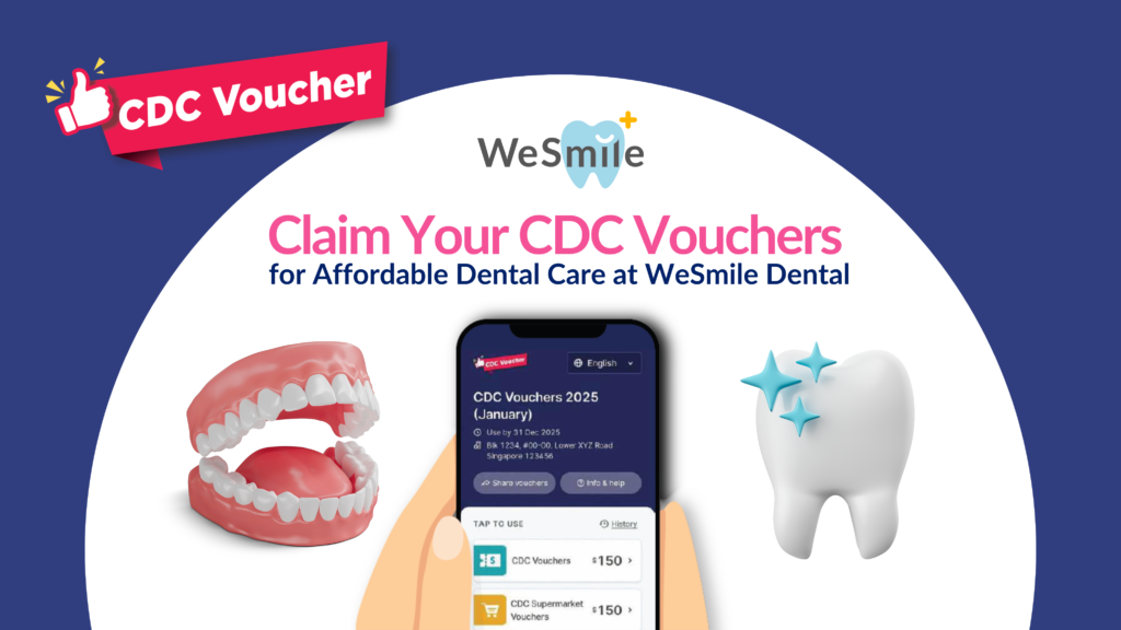 Maximise Your CDC Voucher for Affordable Dental Care at WeSmile Dental